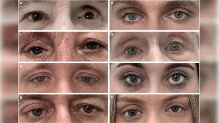 Researchers 3D-Print Realistic, Prosthetic Eyes in Record Time ...