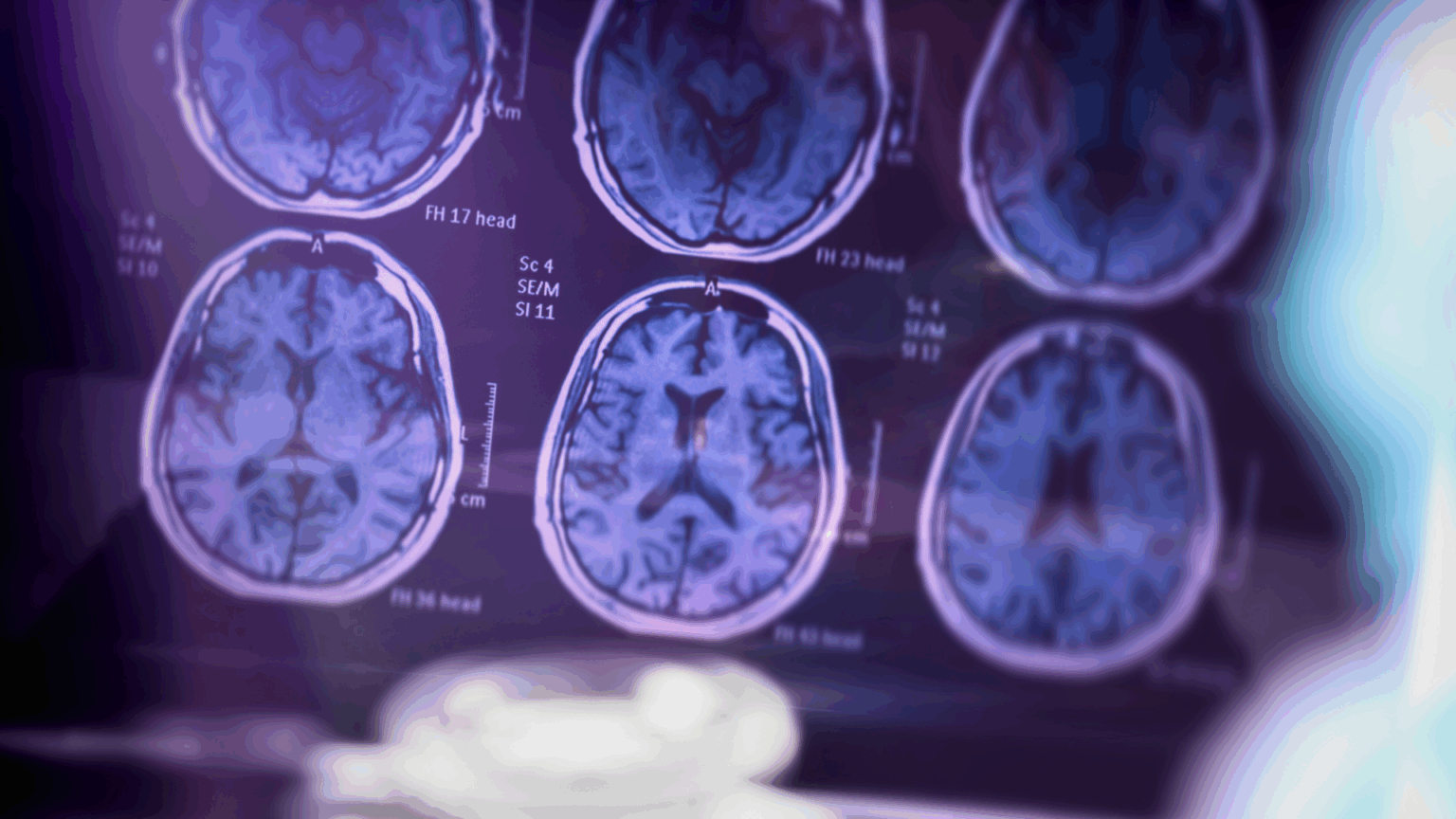 Alzheimers Disease: A Journey to Recovery - Tomorrow's World Today®