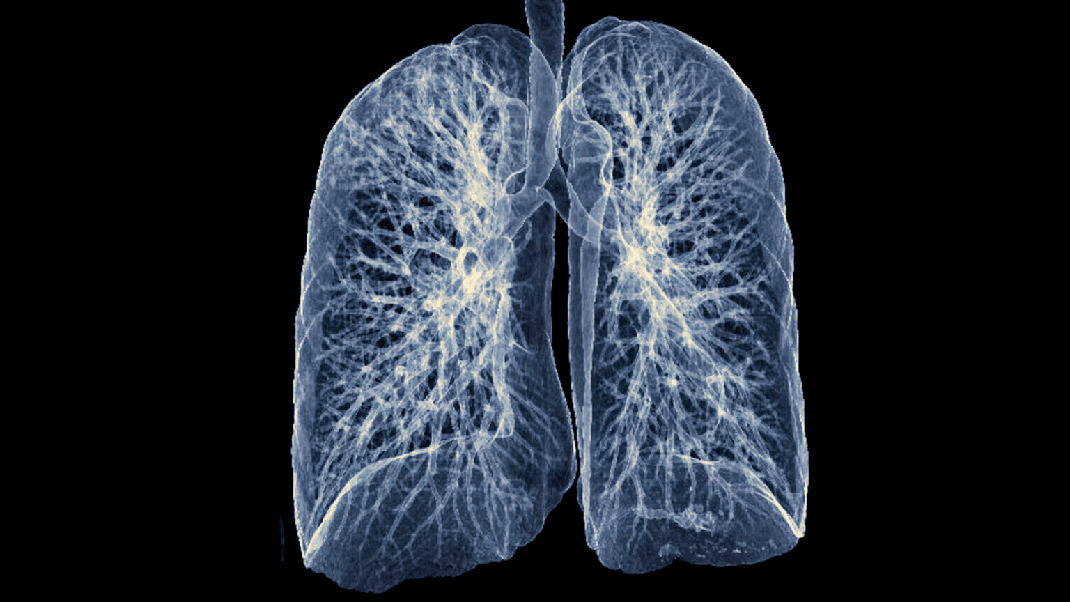 Lab Experiments Identify New Target to Improve Lung Cancer Treatment ...