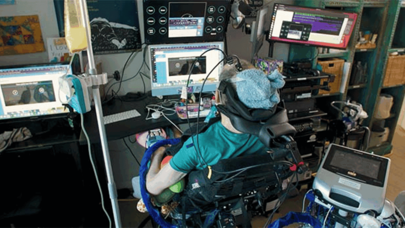 Brain-Computer Interface Enables ALS Patient to Accurately Communicate ...